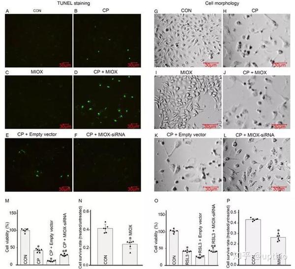 细胞病理性铁死亡？中科院一区带你探索MIOX的妙用 - 知乎