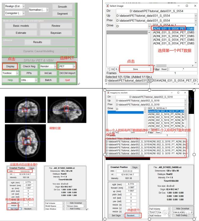 ADNI数据集使用SPM Batch处理脑PET数据（小白记录） - 知乎