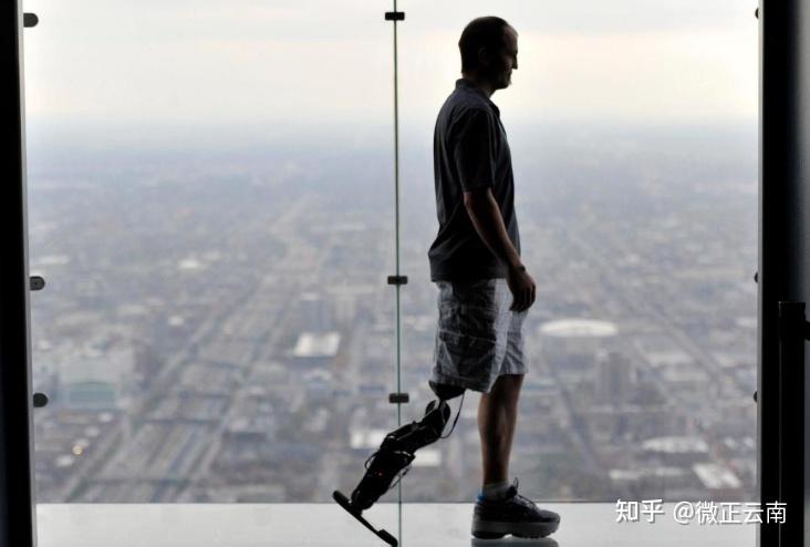 云南假肢安装技术哪家靠谱哪家好？昆明安的好假肢装配公司怎么样 知乎