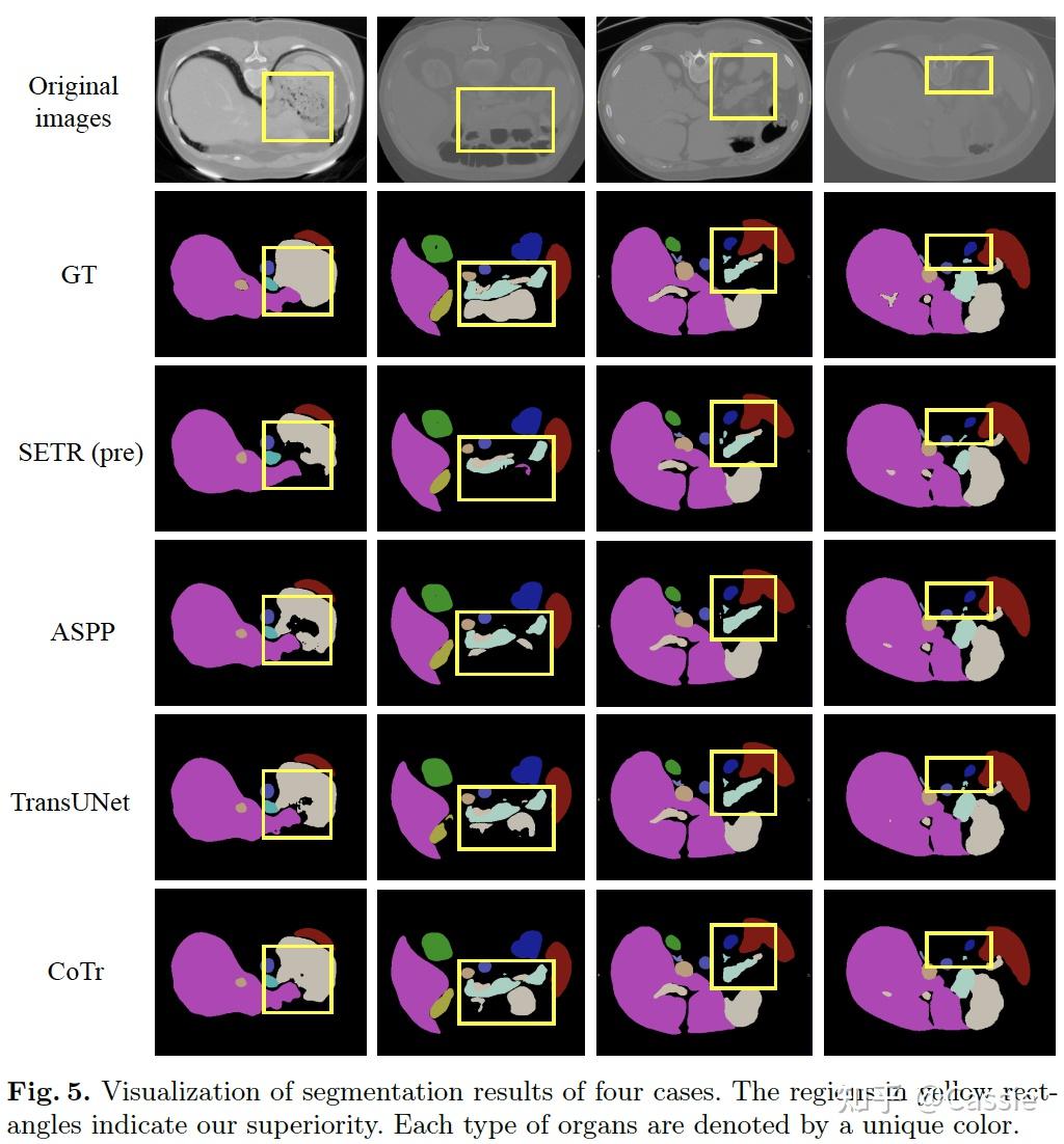 [论文笔记]CoTr: Efficiently Bridging CNN and Transformer for 3D Medical ...