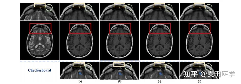 用于多模态MRI重建的具有空间对齐的深度展开网络|文献速递--基于多模态-半监督深度学习的病理学诊断与病灶分割 - 知乎