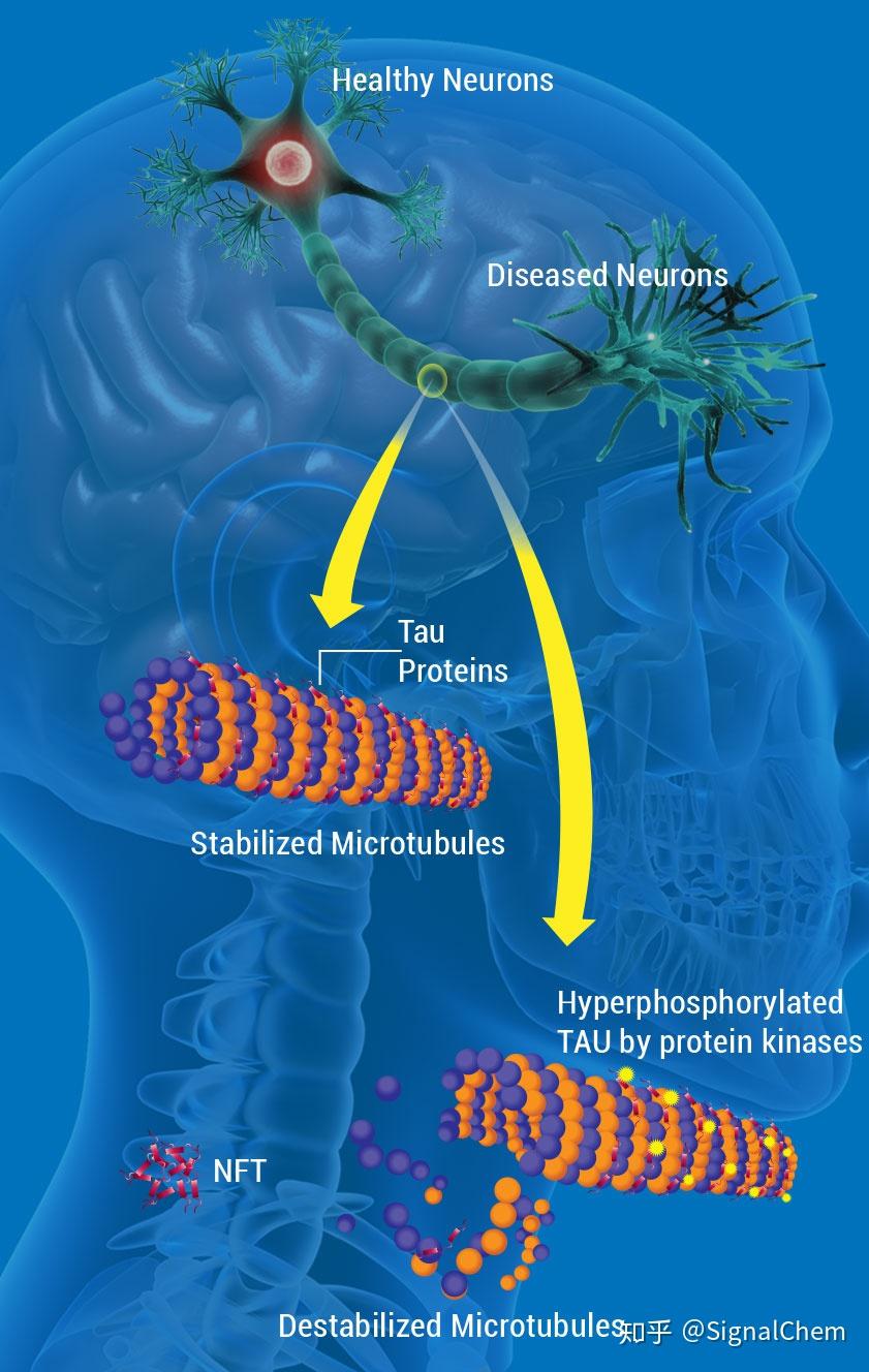 关于 Tau 通路的药物开发策略 - 知乎