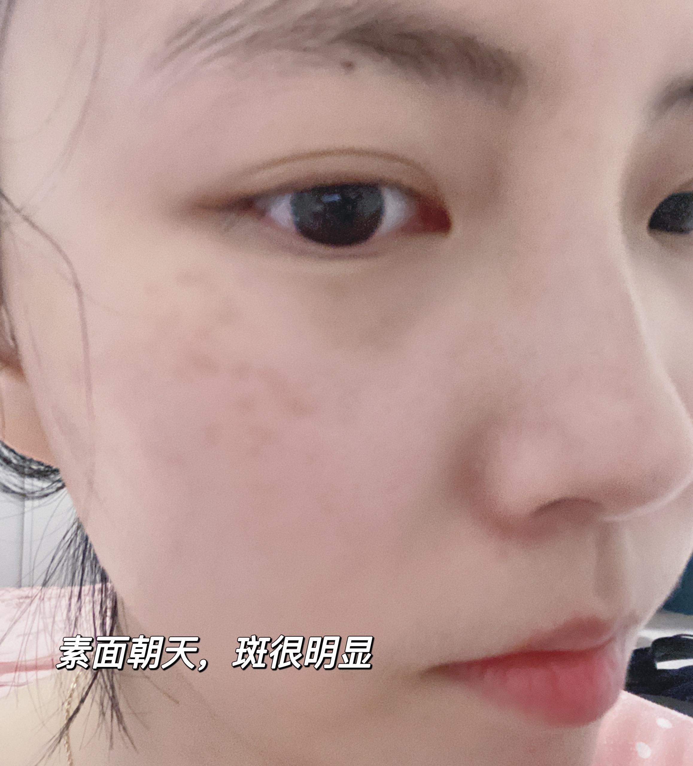 城野 377 美白精华里面的美白成分只有 377 吗?377 的美白原理是什么?