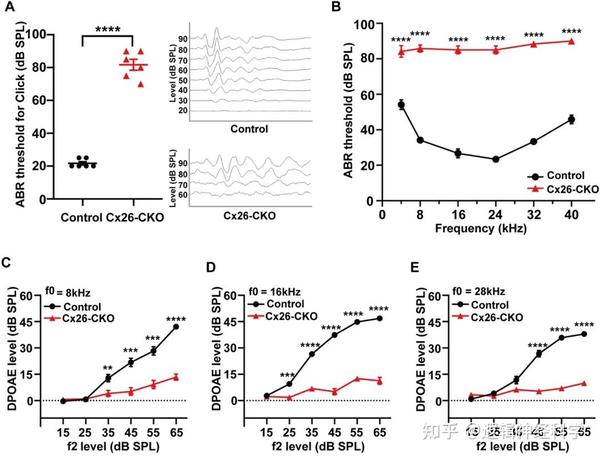 Neurosci Bull︱华中科技大学孙宇团队建立新的Cx26条件敲除小鼠模型，揭示Gjb2敲除小鼠外周听觉系统的病理生理改变 - 知乎