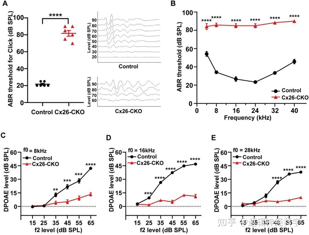 Neurosci Bull︱华中科技大学孙宇团队建立新的Cx26条件敲除小鼠模型，揭示Gjb2敲除小鼠外周听觉系统的病理生理改变 - 知乎