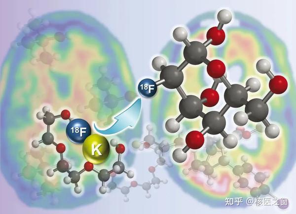 核医学科的“弹药车间”，医用回旋加速器都有哪些临床应用？ - 知乎