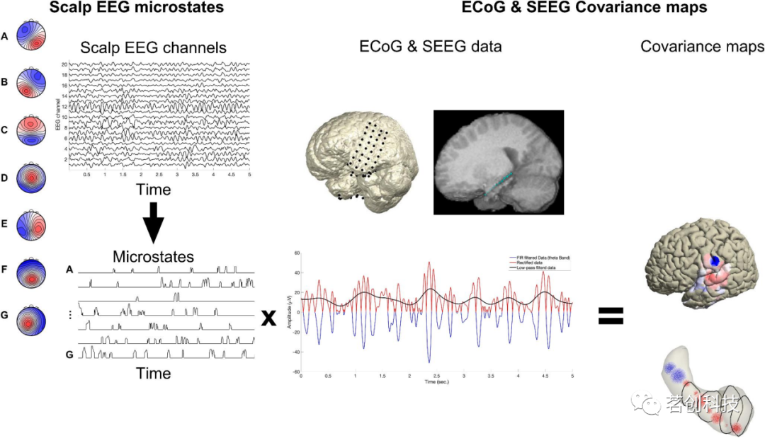 EEG微状态的皮层电图激活模式 - 知乎