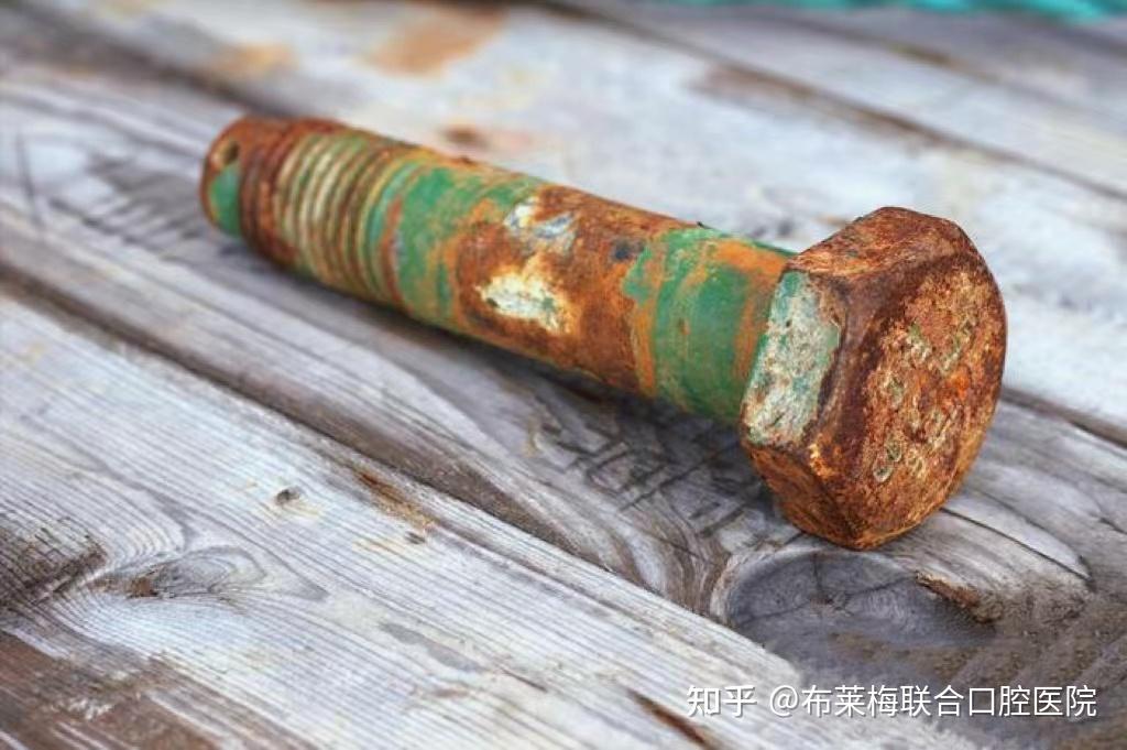 种植牙的“螺丝钉”会生锈？这玩意儿还敢做吗？ - 知乎