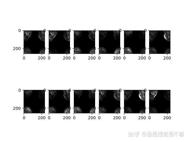MRI重建中的小实验（python） - 知乎