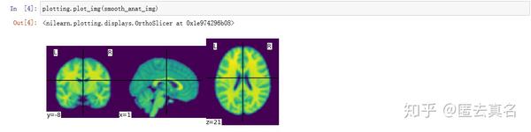 nilearn 笔记（1） - 知乎