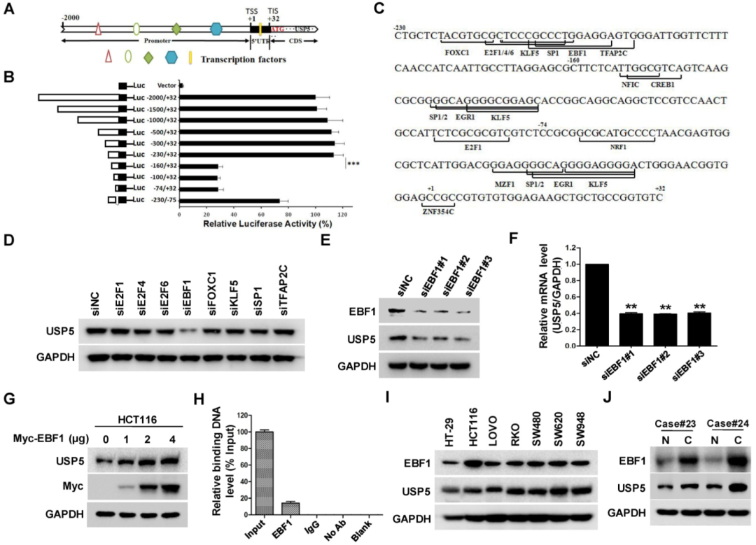 泛素特异性肽酶5通过稳定Tu翻译延伸因子调节结直肠癌细胞生长 - 知乎