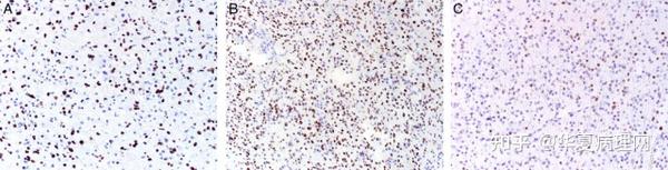 病理检测指标p53大揭秘（三） - 知乎