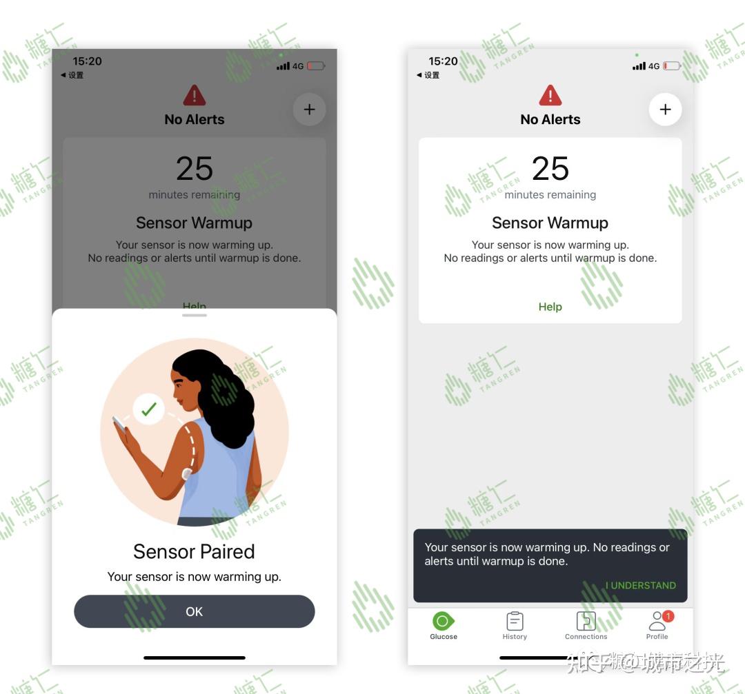 【德康G7】Dexcom G7安装配置教程 - 知乎