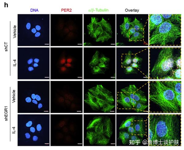 炎症因子IL-4通过EGR1调控节律系统中枢基因PER2 - 知乎