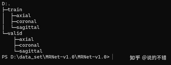 MRNet数据集 - 知乎