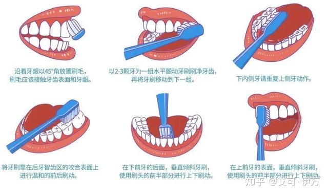 世界标准刷牙姿势 巴氏刷牙法 知乎