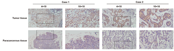 SCI赏图录（8）： 免疫组织化学（IHC） - 知乎