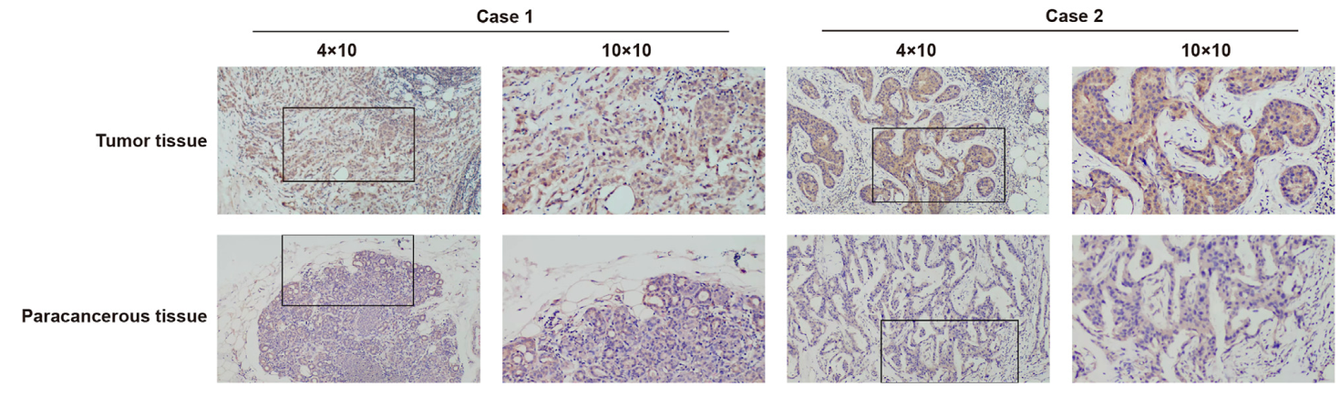 SCI赏图录（8）： 免疫组织化学（IHC） - 知乎