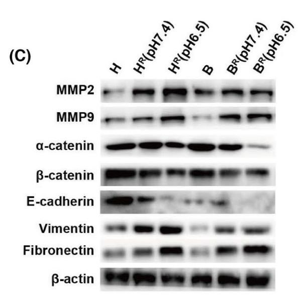 文献精读[酸敏感离子通道与肝癌]:EMT表型 - 知乎