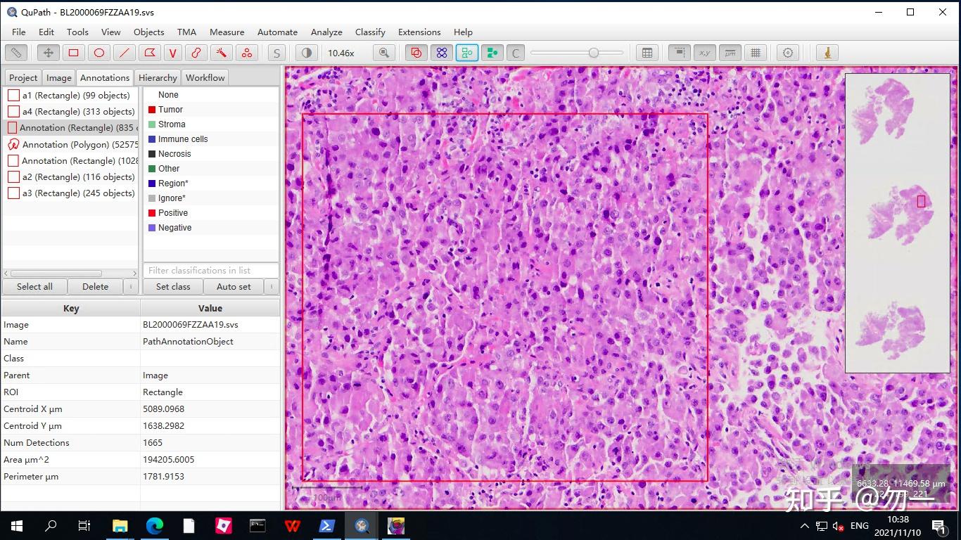 QuPath检测细胞与计算细胞属性 - 知乎