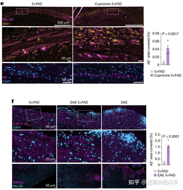 Nature︱德国马普所团队发现阿尔兹海默病中髓鞘功能障碍驱动淀粉样蛋白-β沉积 - 知乎
