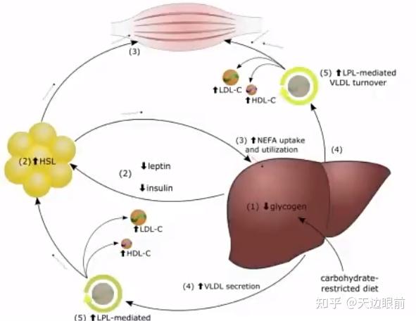 肌肉型（瘦体型）高反应个体（LMHR），总胆固醇、LDL-C 超标并非预示存在心血管疾病高风险，严格的实验数据对比分析提供了有说服力的证据 - 知乎