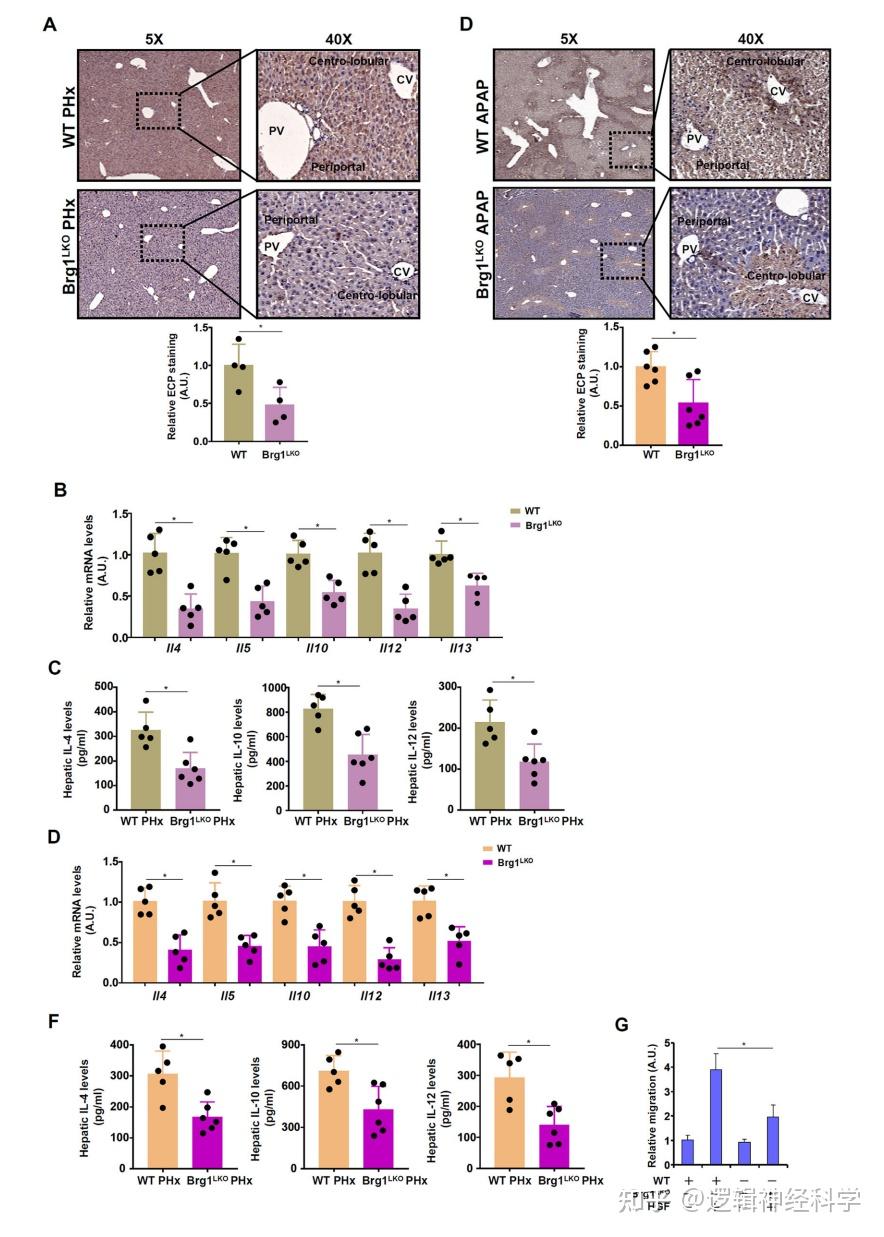 Cell Death Dis︱常州市第一人民医院邹晓平/南京鼓楼医院陆云杰团队合作发现肝再生新机制 - 知乎