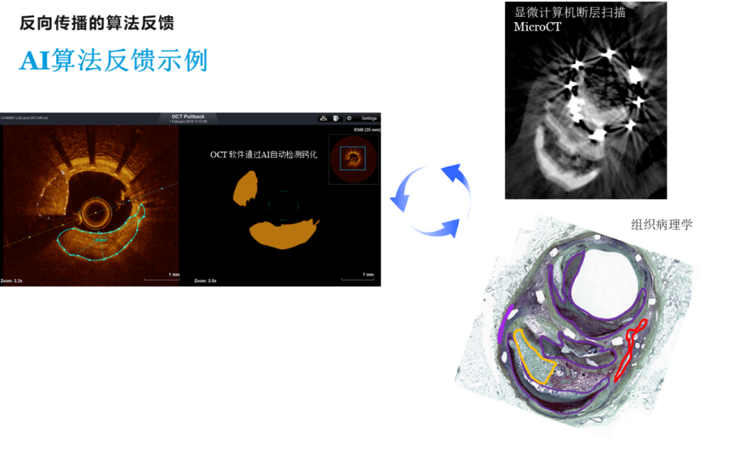 CCEC·前沿技术｜当人工智能“预见”OCT - 知乎