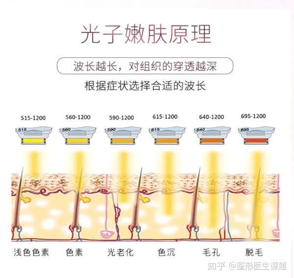谭超:水光针和光子嫩肤有什么区别? 知乎