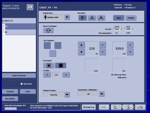 AEC的原理与应用 - 知乎