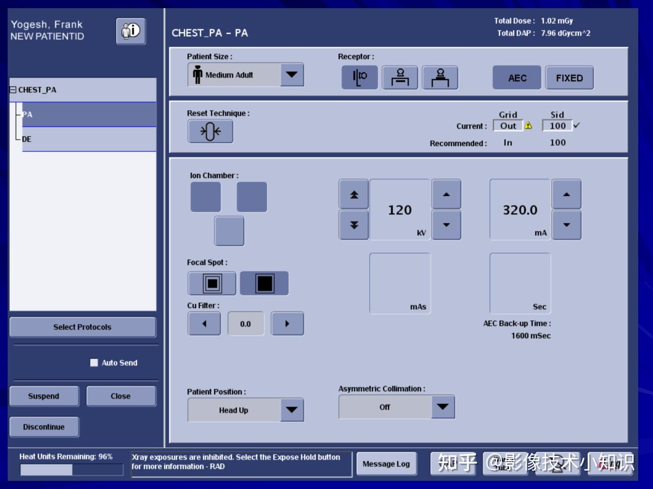 AEC的原理与应用 - 知乎