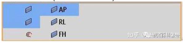 4D-Flow扫描数据采集：序列及参数 - 知乎