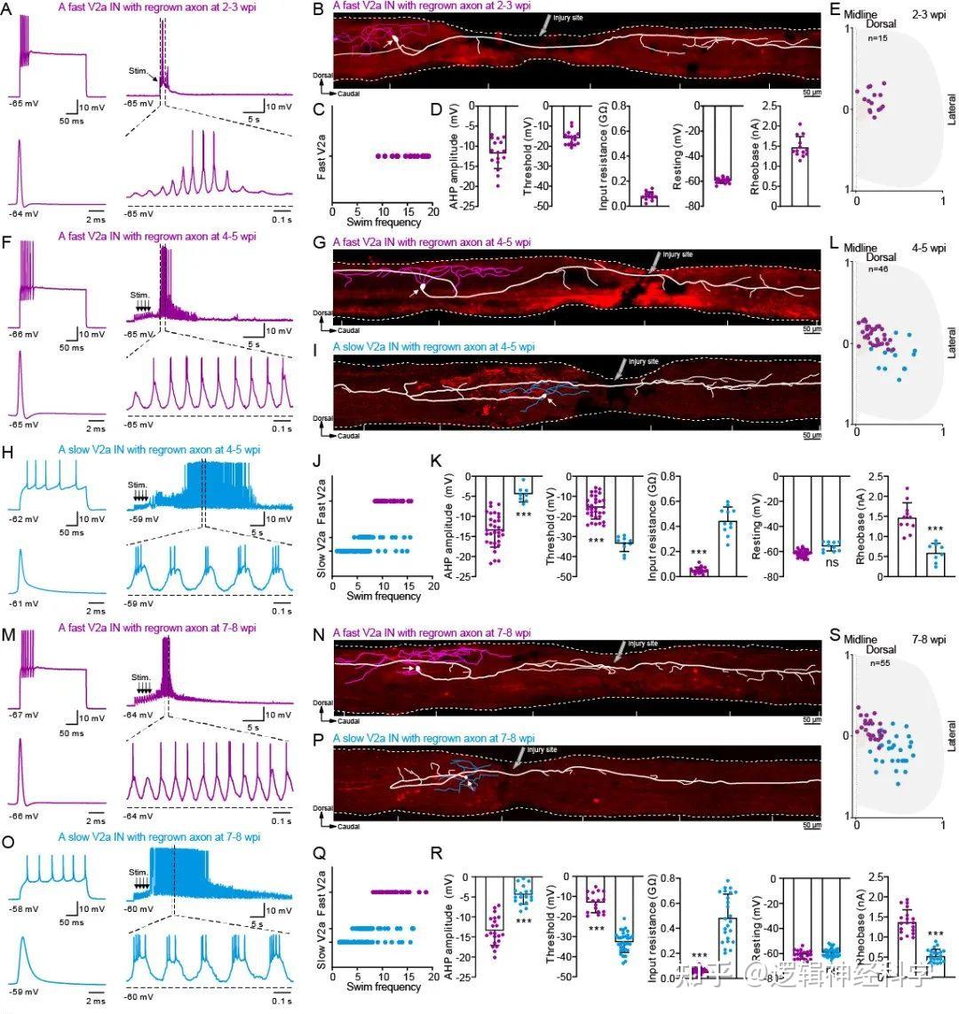 Cell Rep︱同济大学宋建人课题组揭示脊髓损伤后脊髓环路重建的新规律 - 知乎