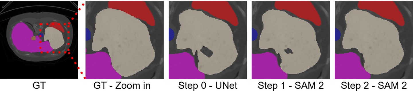 【arXiv 2502】RFMedSAM 2：基于SAM 2的自动提示精炼方法以增强体积医学图像分割性能（） - 知乎