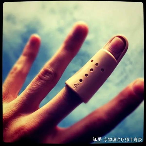 槌状指(Mallet Finger)——手指伸肌腱断裂 - 知乎