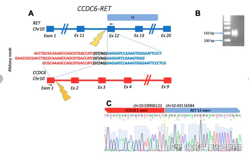 案例报告：卡博替尼在患有获得性CCDC6-RET融合的EGFR突变非小细胞肺癌患者中的临床试验数据惊喜，耐受性良好！ - 知乎