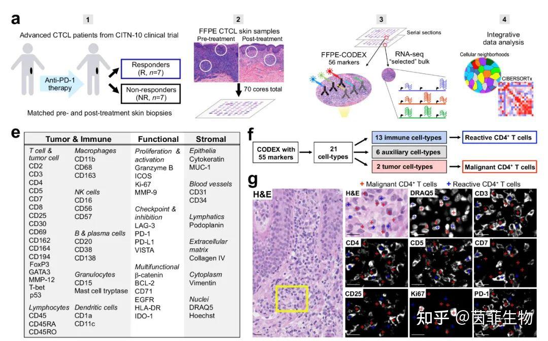 Nat Commun | CODEX——SpatialScore预测皮肤T细胞淋巴瘤对PD-1阻断响应的空间生物标志物 - 知乎