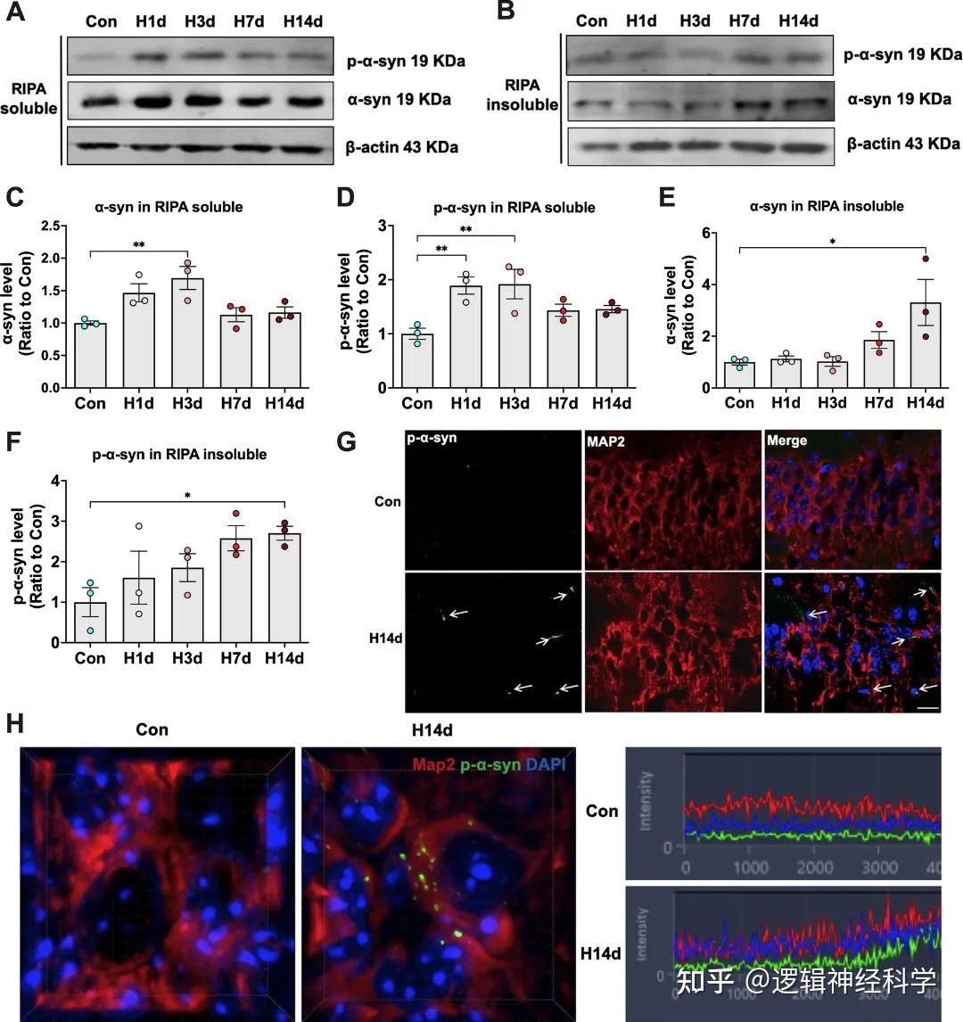 Cell Death Discov︱吉训明团队揭示慢性低氧是诱导α-突触核蛋白病理的新机制 - 知乎