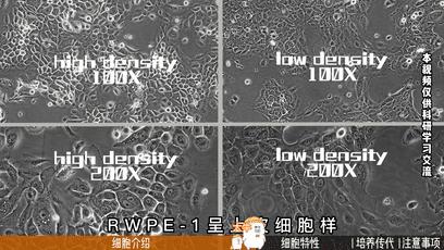 RWPE-1细胞培养，人前列腺正常细胞培养攻略 - 丰晖生物 - 知乎