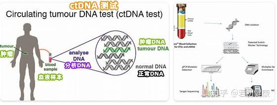 Ki67、脉管癌栓、ctDNA ？揭秘乳腺癌预后的“真相” - 知乎