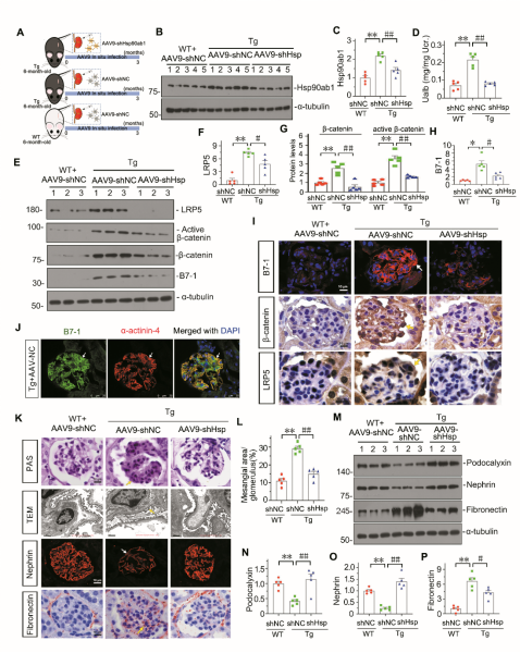 Cell Death Differ｜周丽丽团队发现足细胞损伤的重要机制 - 知乎