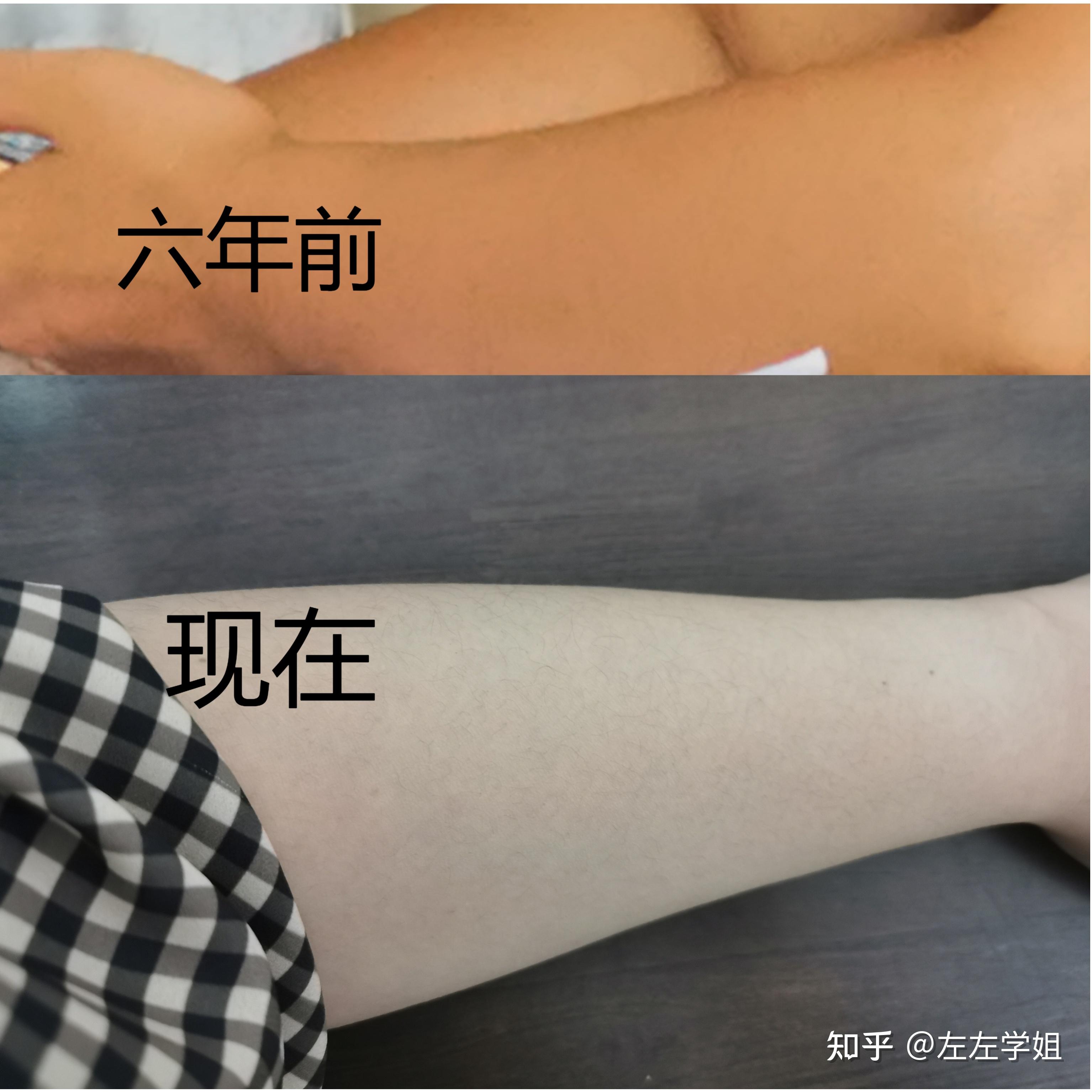 5个皮肤变白好习惯,让你白到发光,亲测有效! 知乎