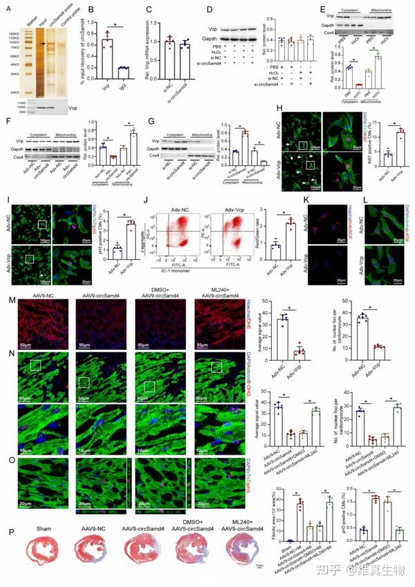 CircRNA研究新进展！宾建平教授团队揭示线粒体定位的circSamd4是MI后心力衰竭的新型治疗靶点！ - 知乎