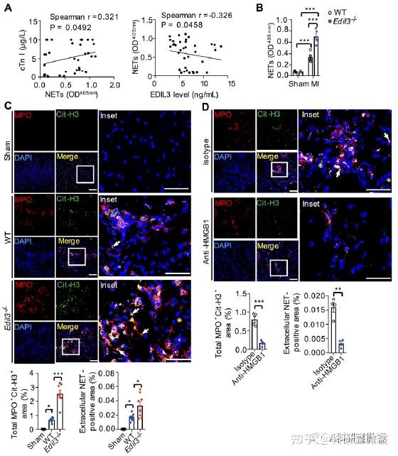 通过多篇10+高分文献结果揭示国自然热点中性粒细胞胞外诱捕网（NETs）相关实验 - 知乎