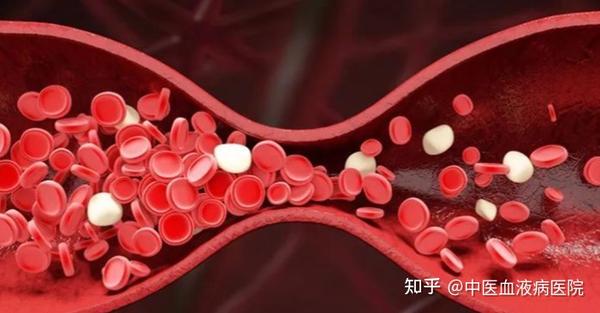刚输完血小板没几天数值又降了,这是为什么?输血小板到底有用吗? 知乎