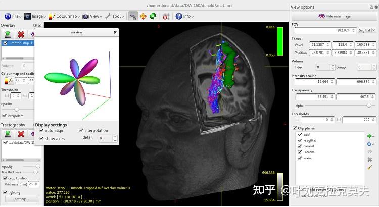 科学可视化软件介绍 – 医学图像处理和可视化开放软件框架MRtrix3 - 知乎