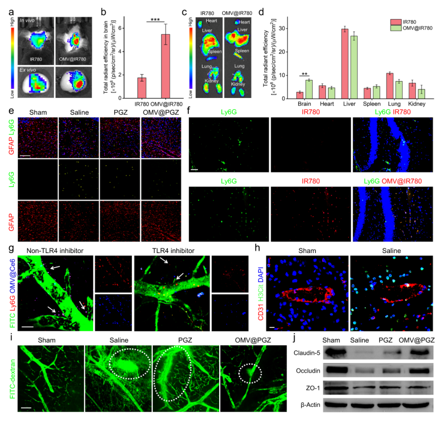 神经保护药物难以穿过BBB？那就搭“便车”！Adv. Mater.：西南交大周绍兵/郭星团队开发出跨BBB纳米药物转运平台 - 知乎