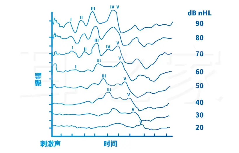 宝宝听力检查——听性脑干反应ABR - 知乎