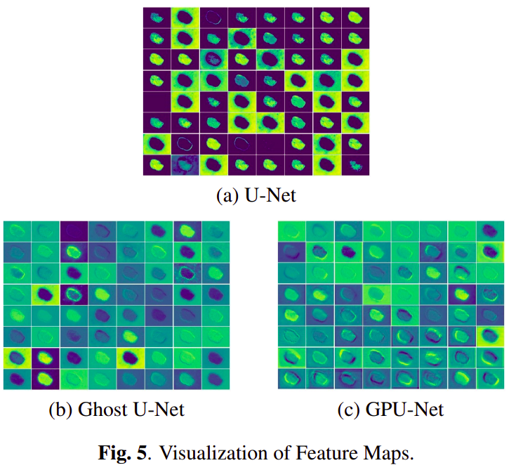 【arXiv:2201】GPU-Net：具有更多样化特征的轻量级 U-Net - 知乎