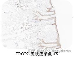 【IHC精准检测】——三阴性乳腺癌伴随诊断关键抗体：TROP-2 - 知乎